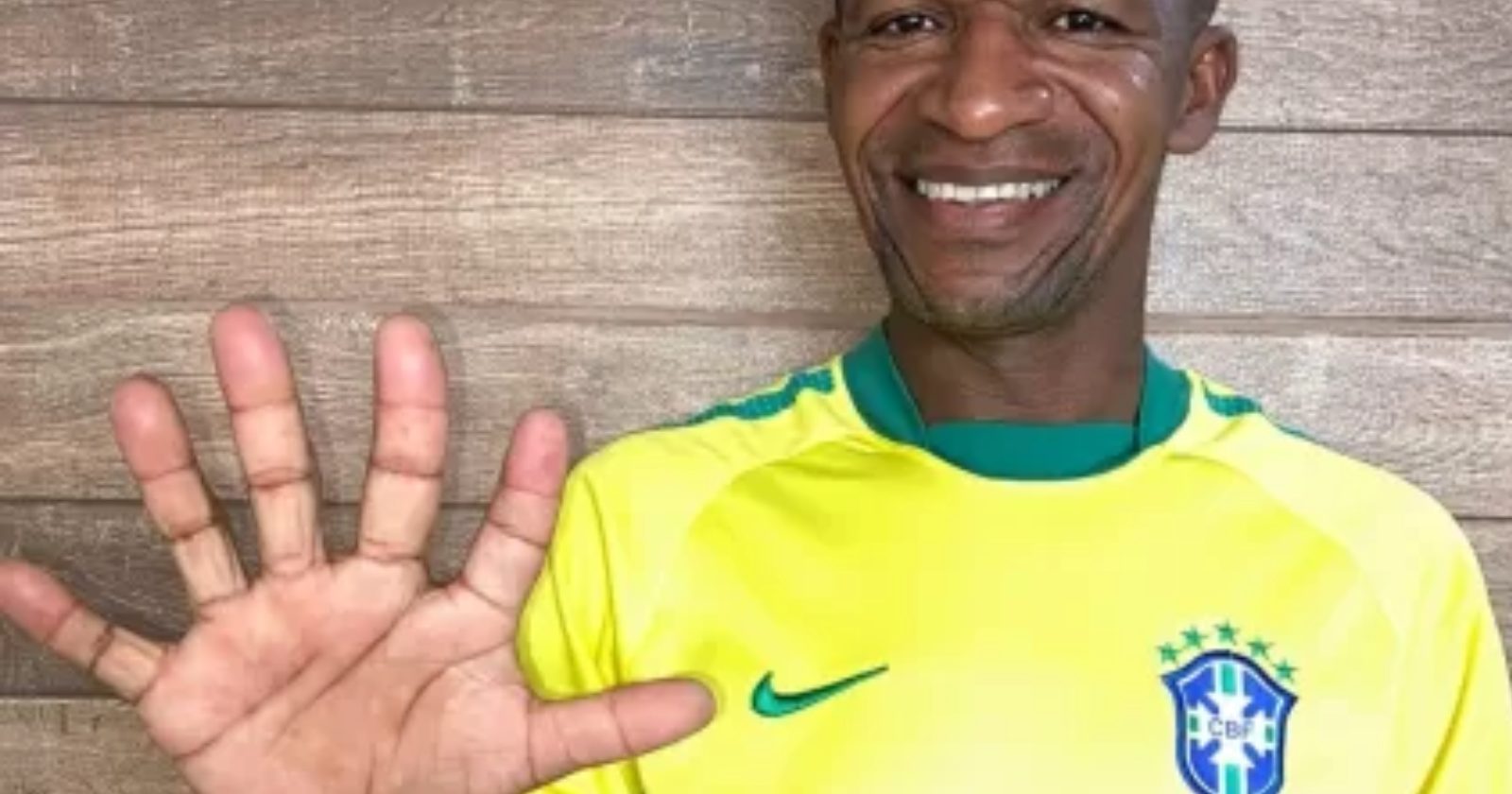 Torcedor brasileiro de 6 dedos é o novo astro da Copa; o hexa tá na mão ...