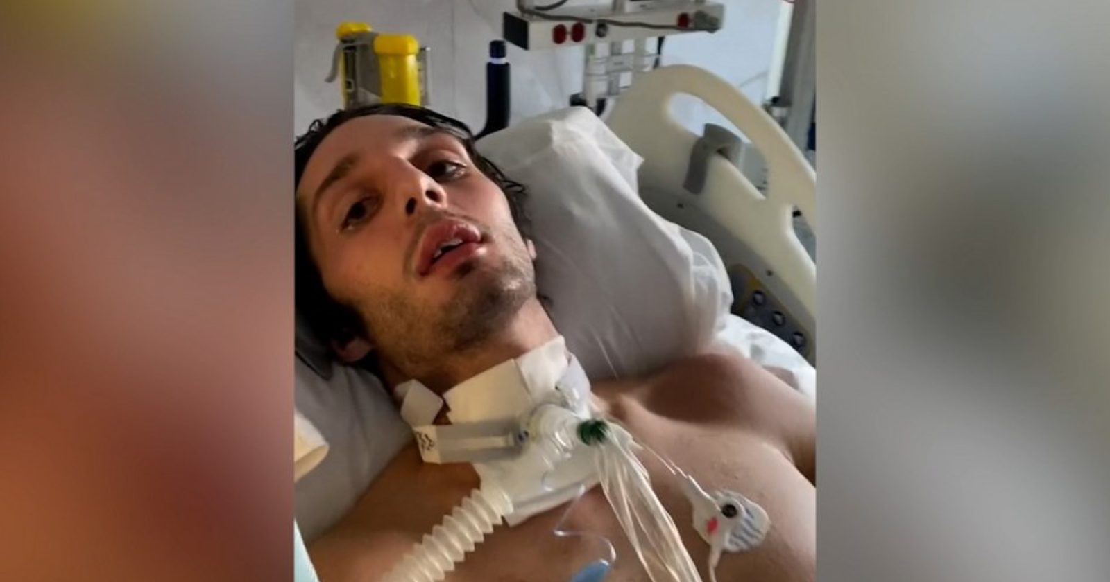 Jovem ator que ficou paralisado do pescoço para baixo tem recuperação ...
